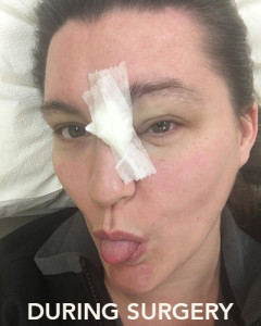 The Day After My MOHS Surgery